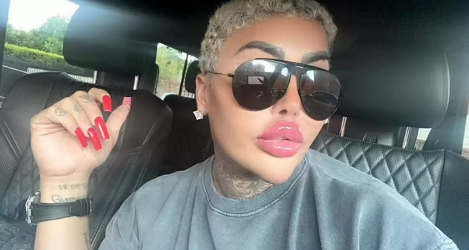 'The Lip King' Arrested Over Mother's Death In Butt Lift Procedure ...